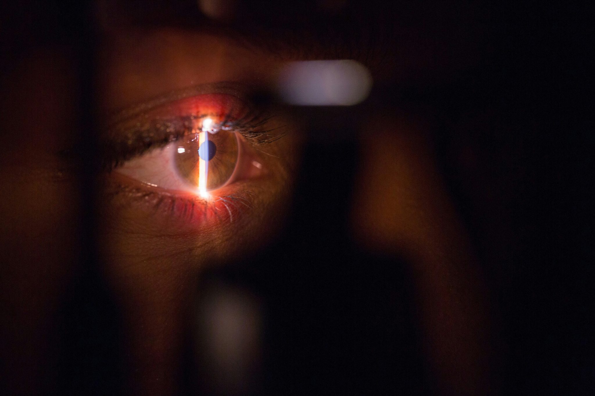 Conjunctivitis (Pink Eye): Symptoms, Causes & Treatments - The Surgi Center
